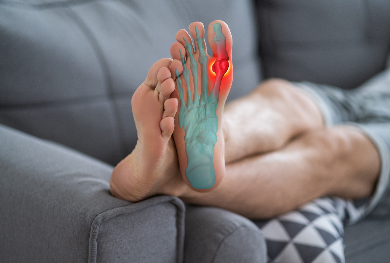 Sintomi Alluce Valgo: Guida Completa per Riconoscerli - Foothealth